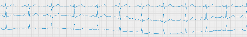Ruhe-EKG, Langzeit EKG – Hausarztpraxis Dr. med. Angelika Kahlert